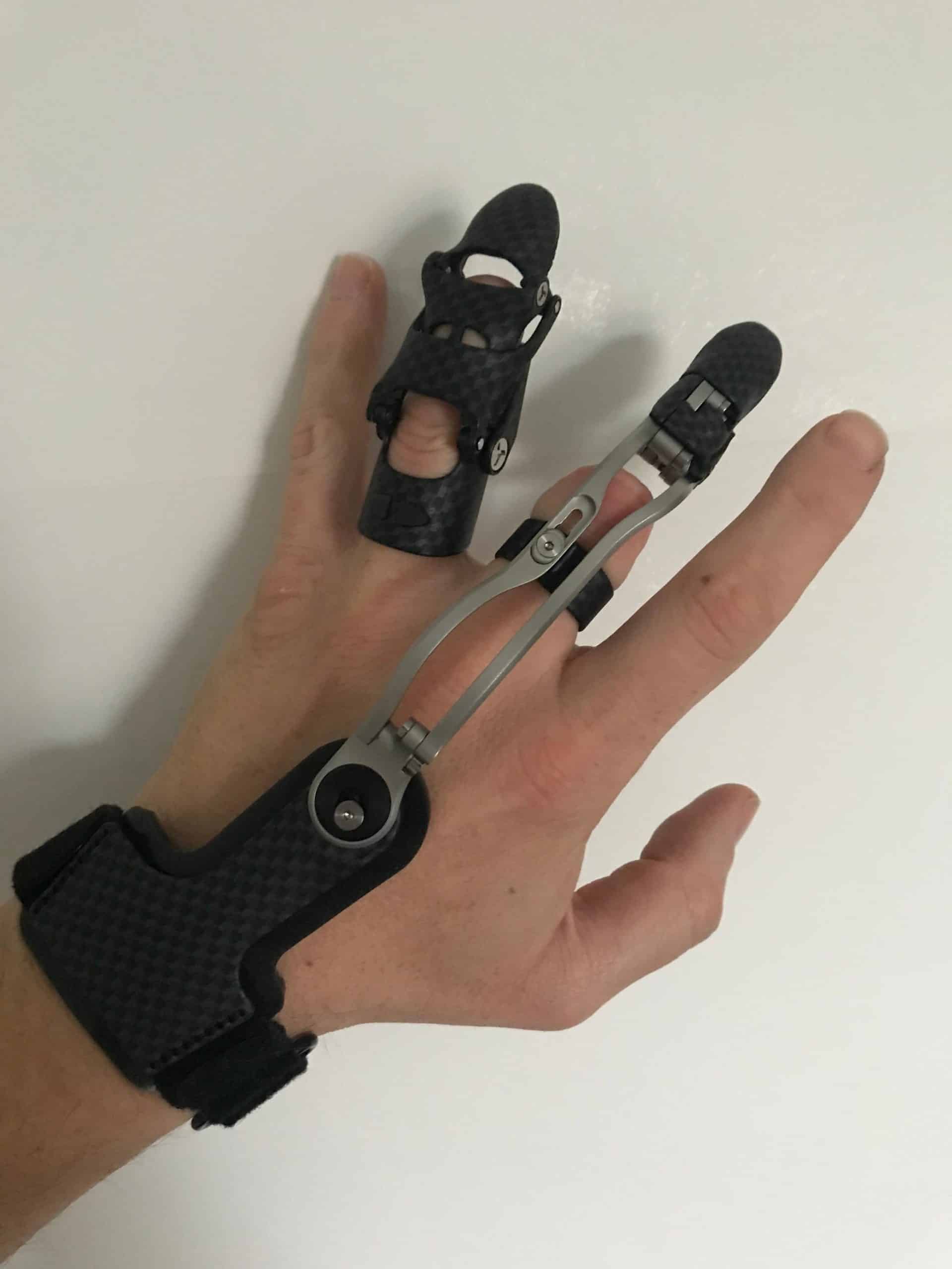 Naked Prosthetics help amputee to regain independence - Moore Barlow LLP