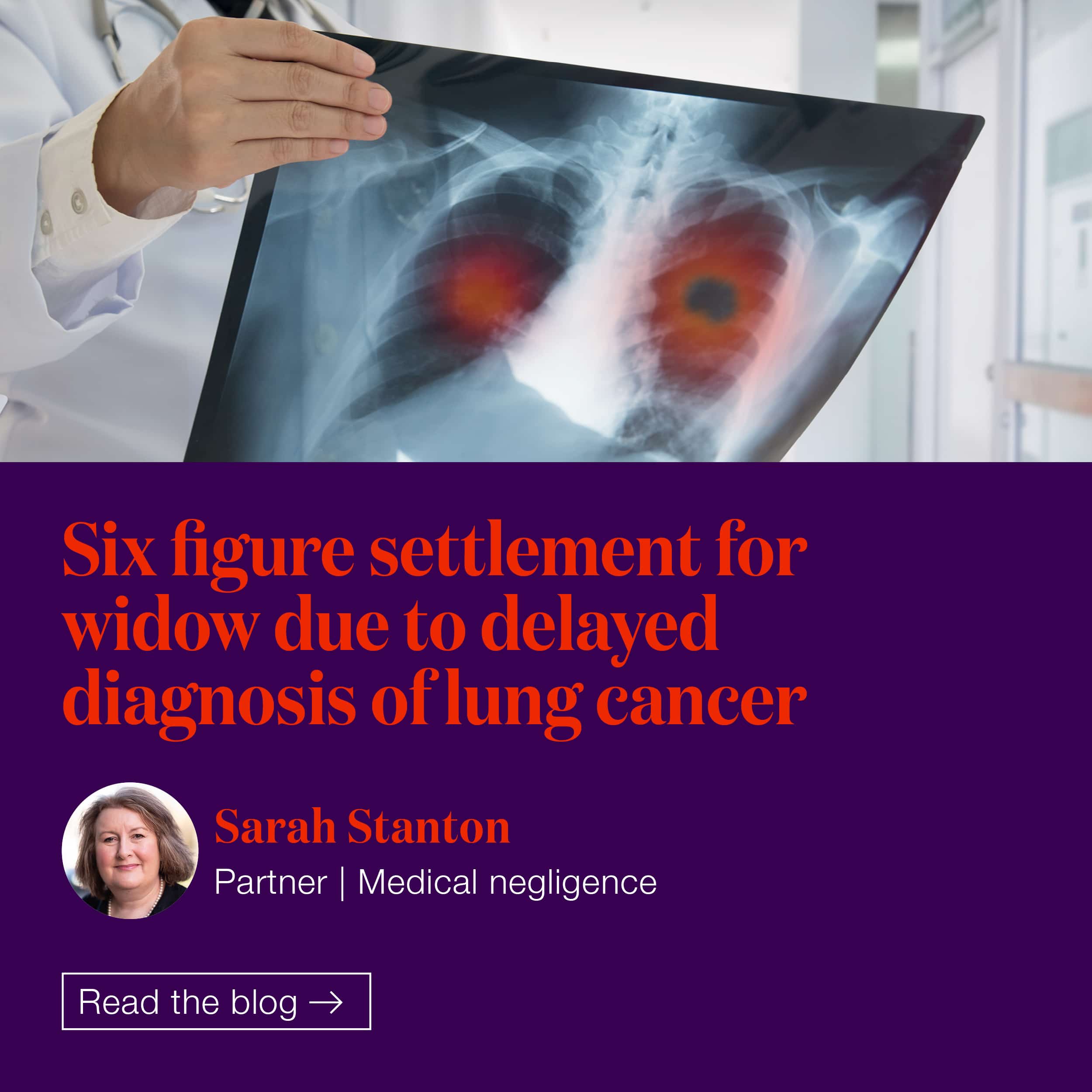 Six figure settlement for widow due to delayed diagnosis of lung cancer ...