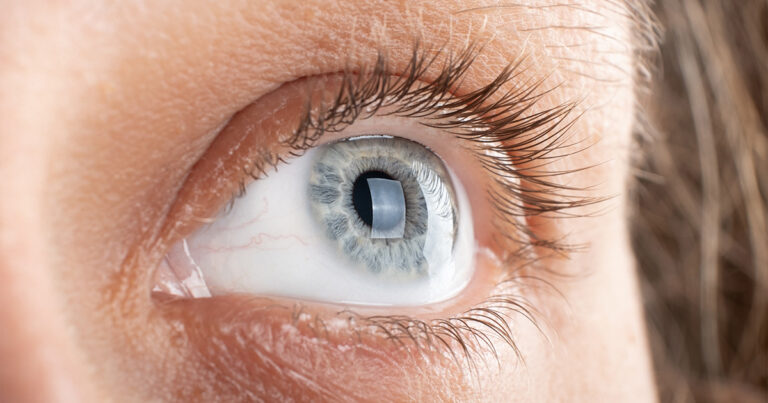 What is an unless order? - Moore Barlow LLP